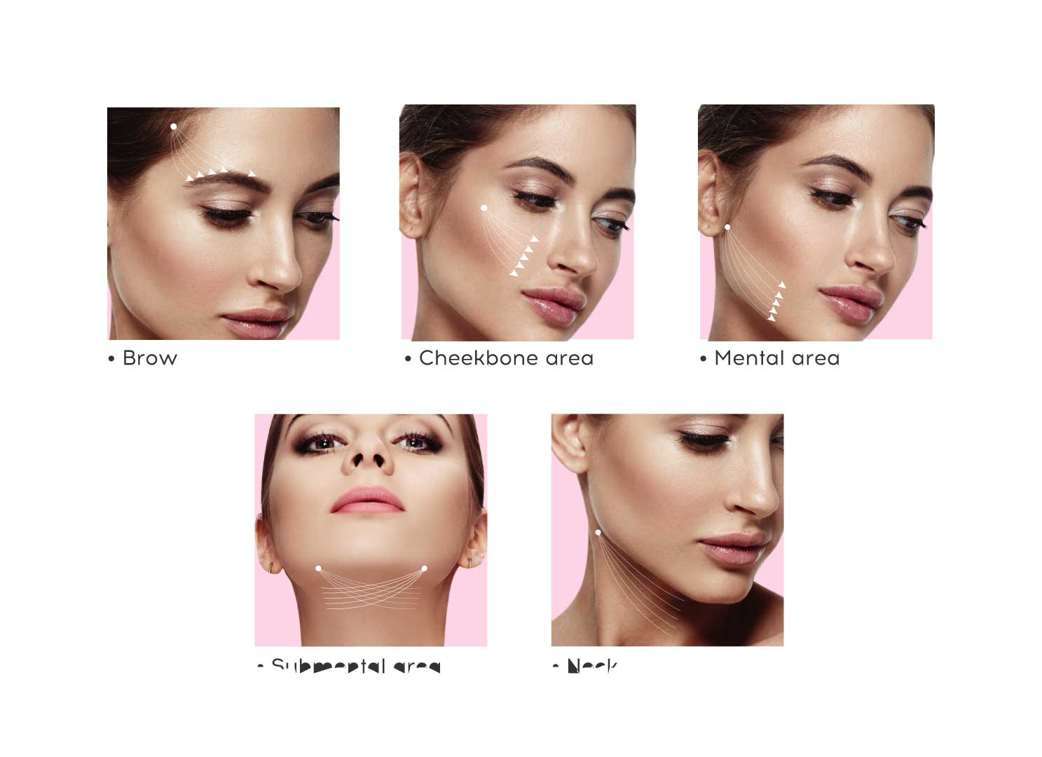 Aptos Nano - Excellence Method | Medica